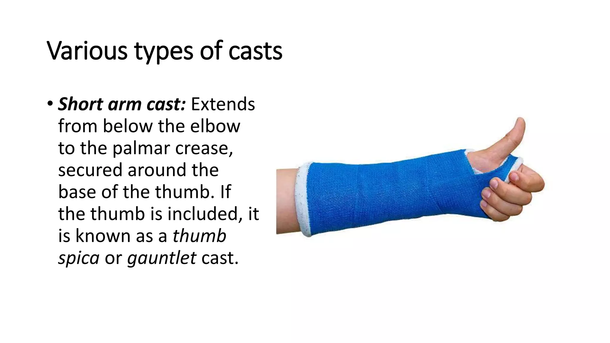 indication and contra-indication cast & traction | PPTX