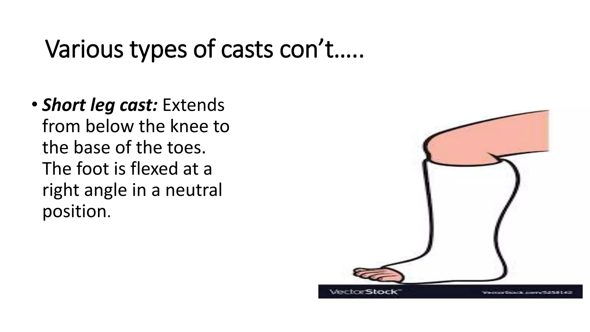 indication and contra-indication cast & traction | PPTX