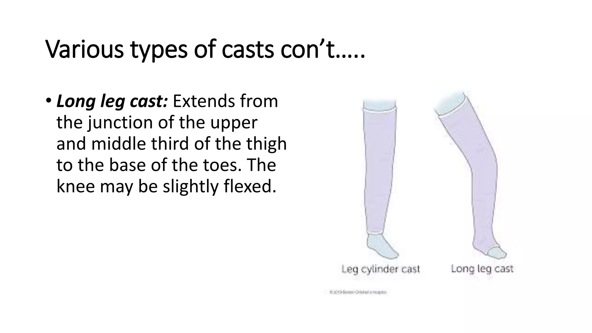 indication and contra-indication cast & traction | PPTX