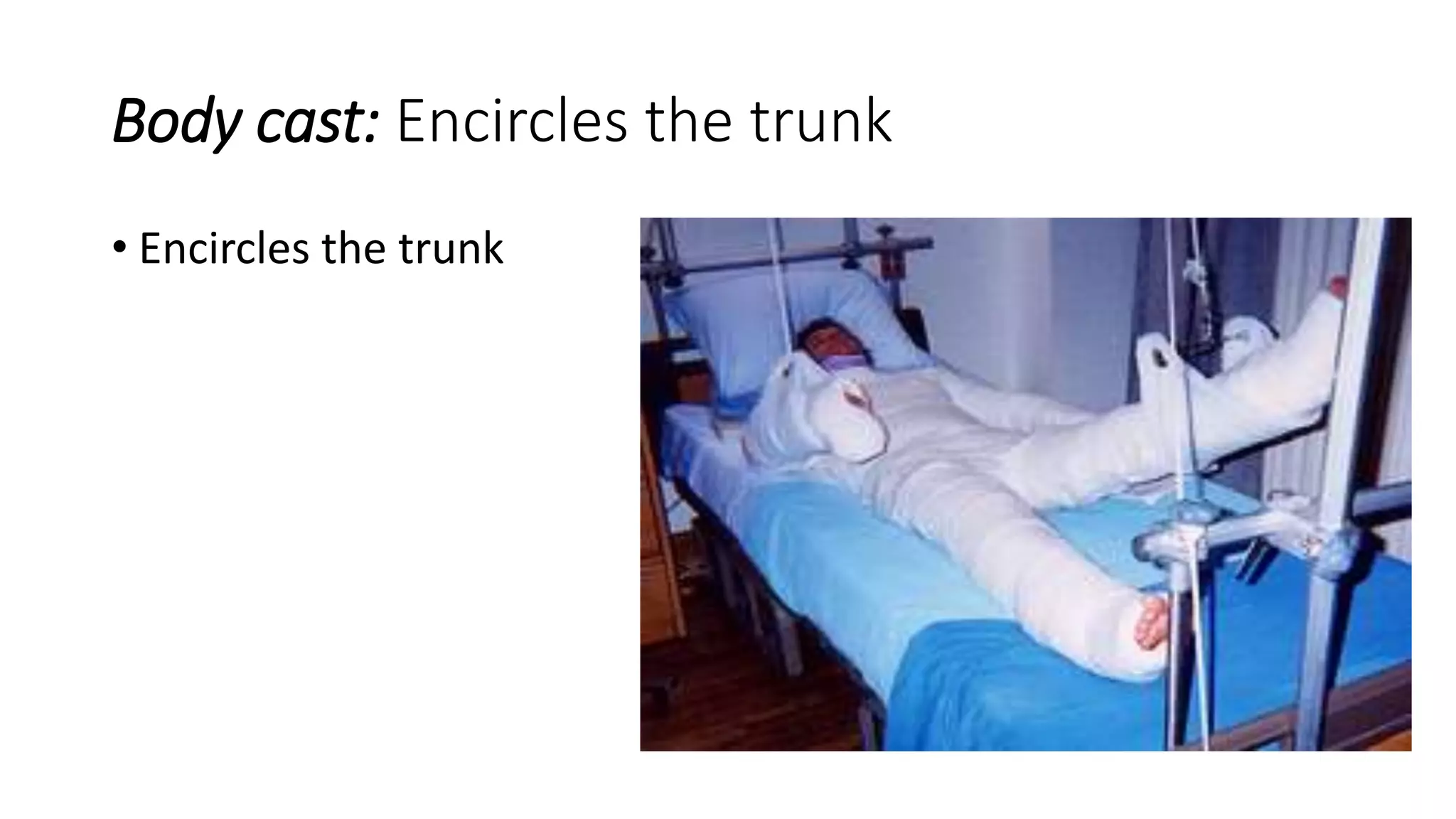 indication and contra-indication cast & traction | PPTX