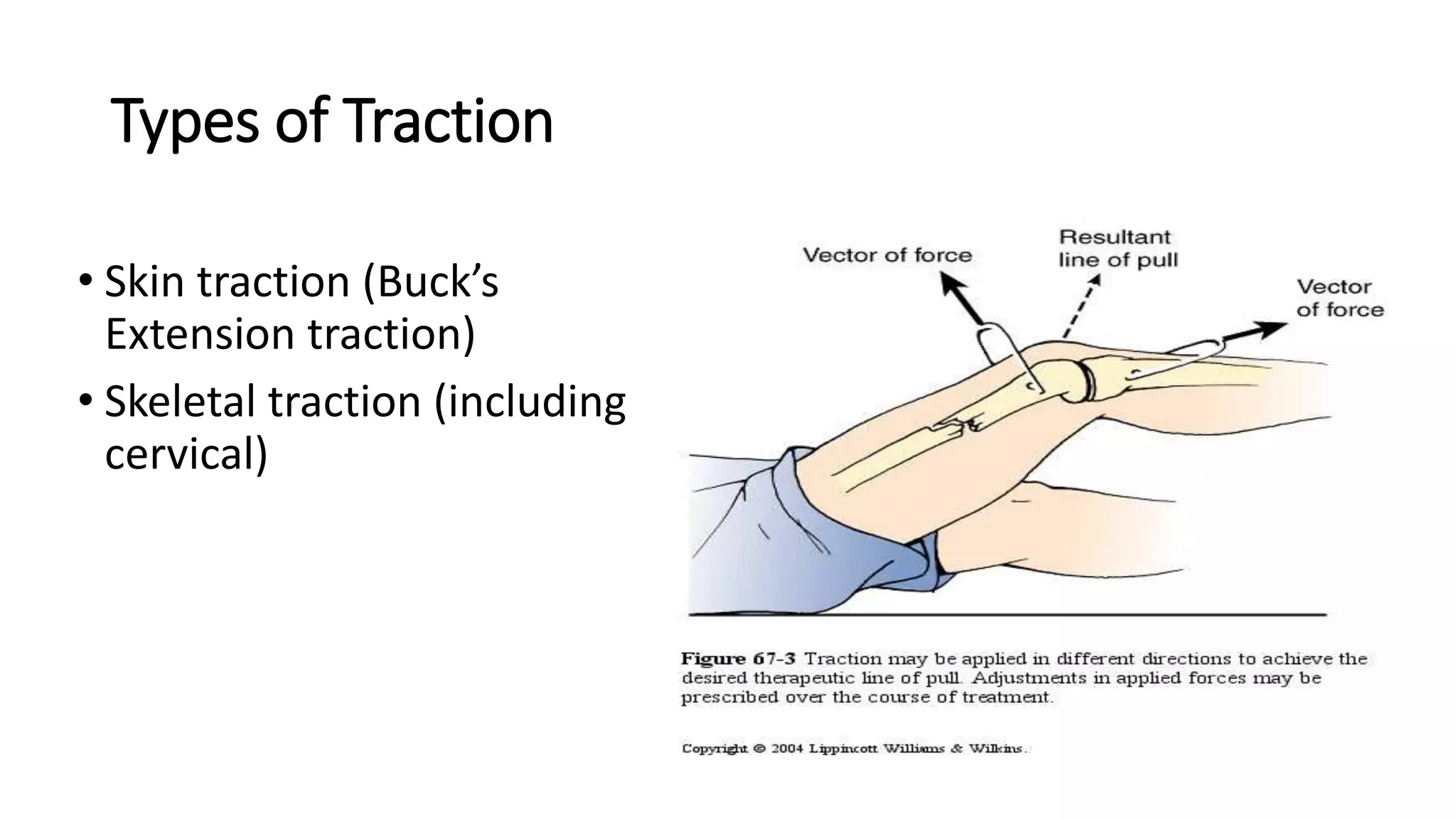 indication and contra-indication cast & traction | PPTX