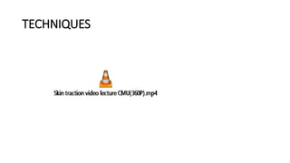 indication and contra-indication cast & traction | PPTX