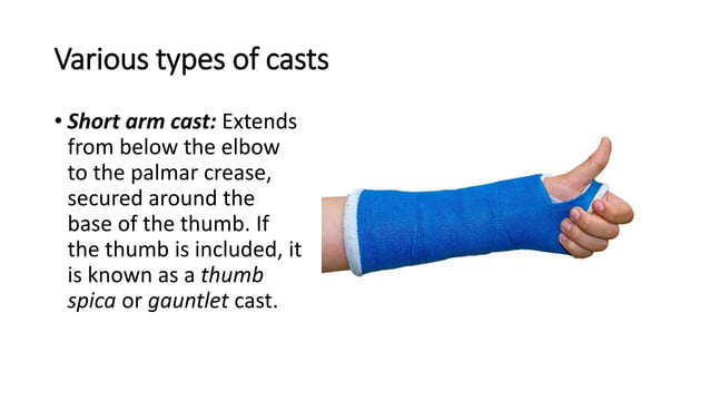indication and contra-indication cast & traction | PPTX | Death, Injury ...
