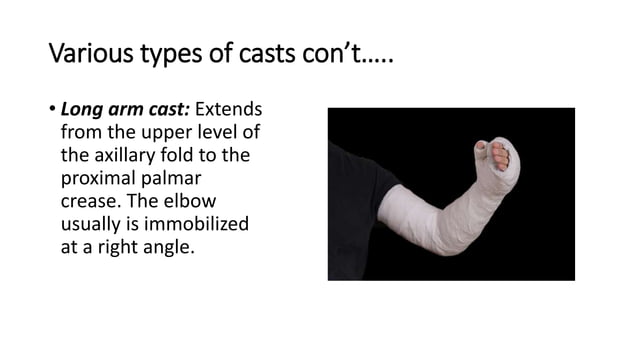 indication and contra-indication cast & traction | PPTX | Death, Injury ...