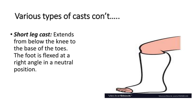 indication and contra-indication cast & traction | PPTX | Death, Injury ...
