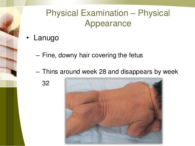 Power point -_assessment_of_the_neonate (1)