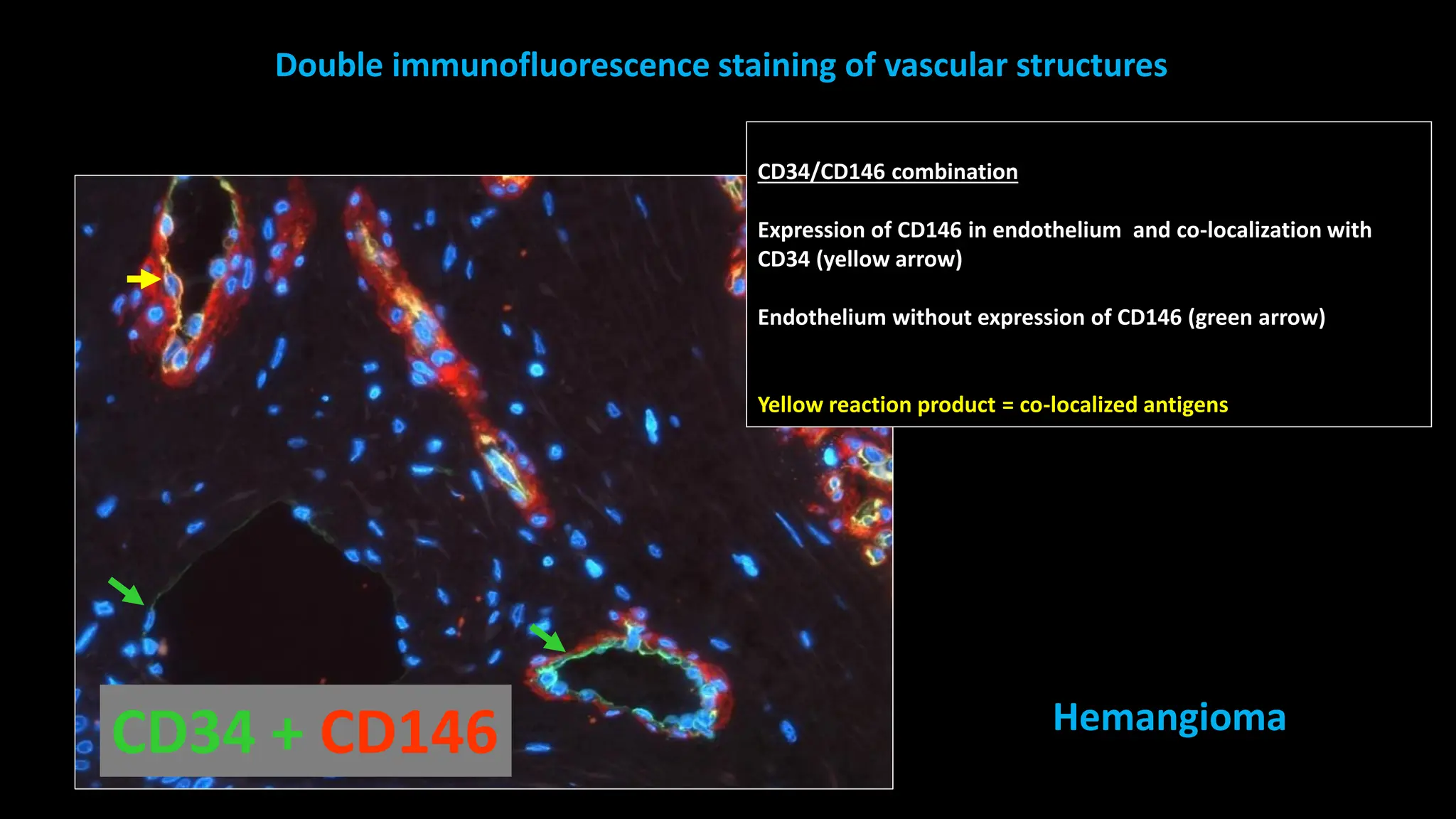 immunohistochemical double staining on formalin fixed paraffin embedded ...