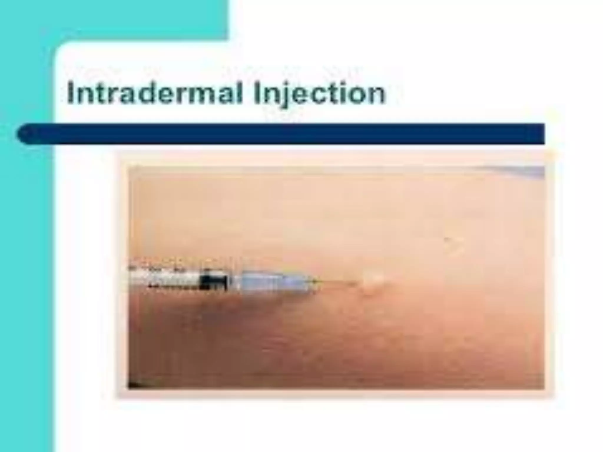 Safe injection practice for nurses | PPSX