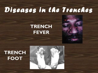 Powerpoint trenches | PPT