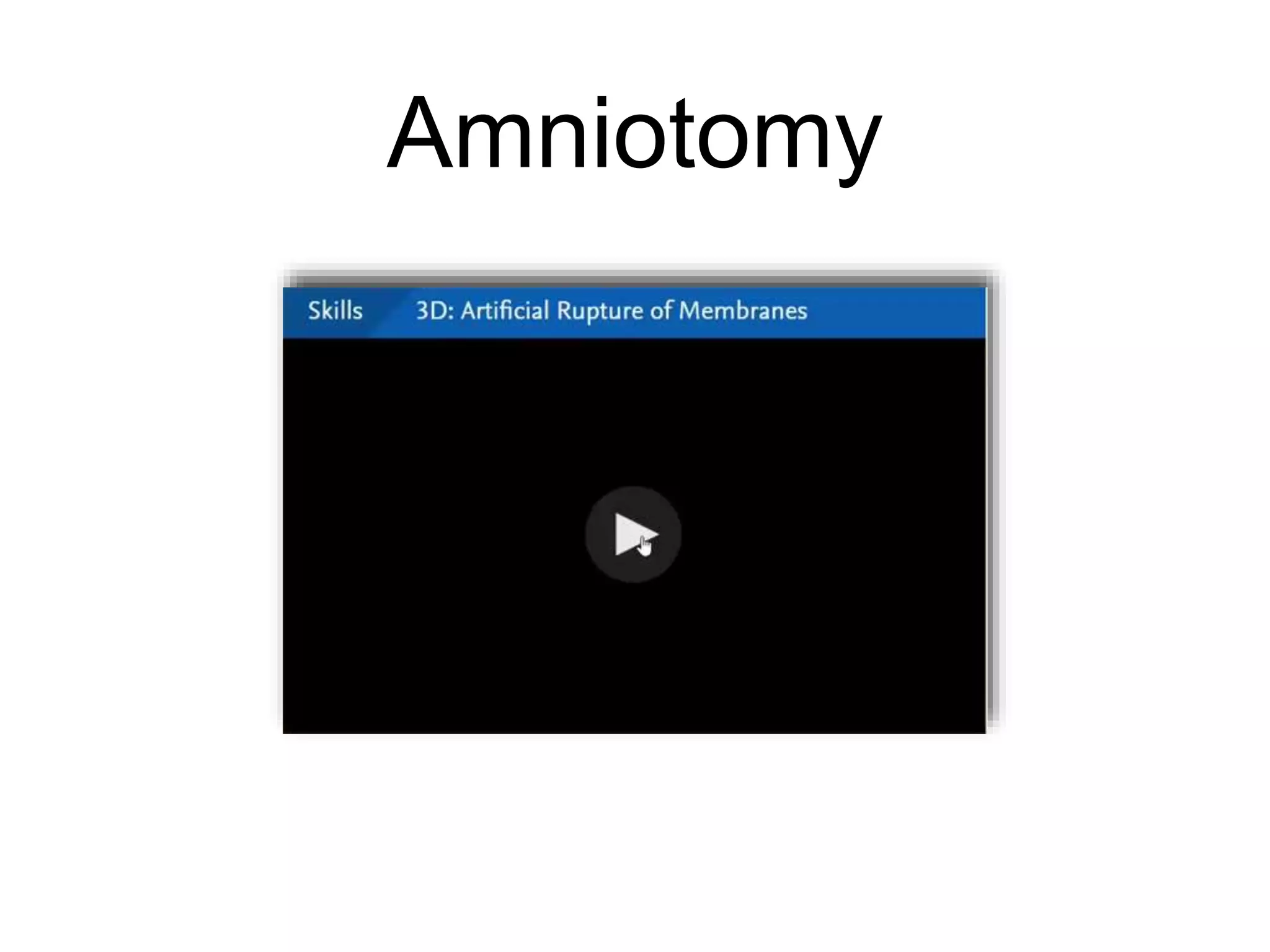 amniotomy, episiotomy.pptx