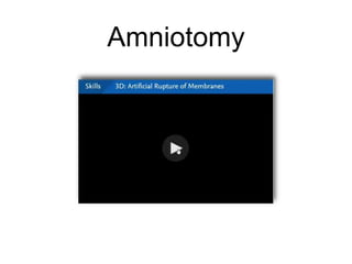 amniotomy, episiotomy.pptx