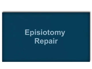 amniotomy, episiotomy.pptx