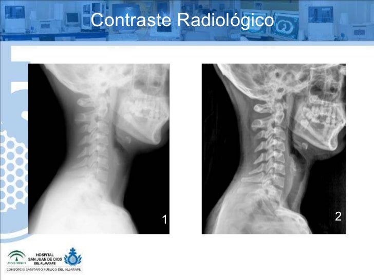 FUNDAMENTOS DE LOS EXÁMENES RADIOGRÁFICOS ESPECIALES. USO DE MEDIOS DE ...