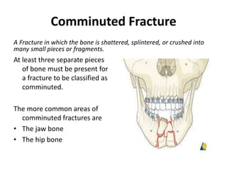 Chosen Fracture Types | PPTX