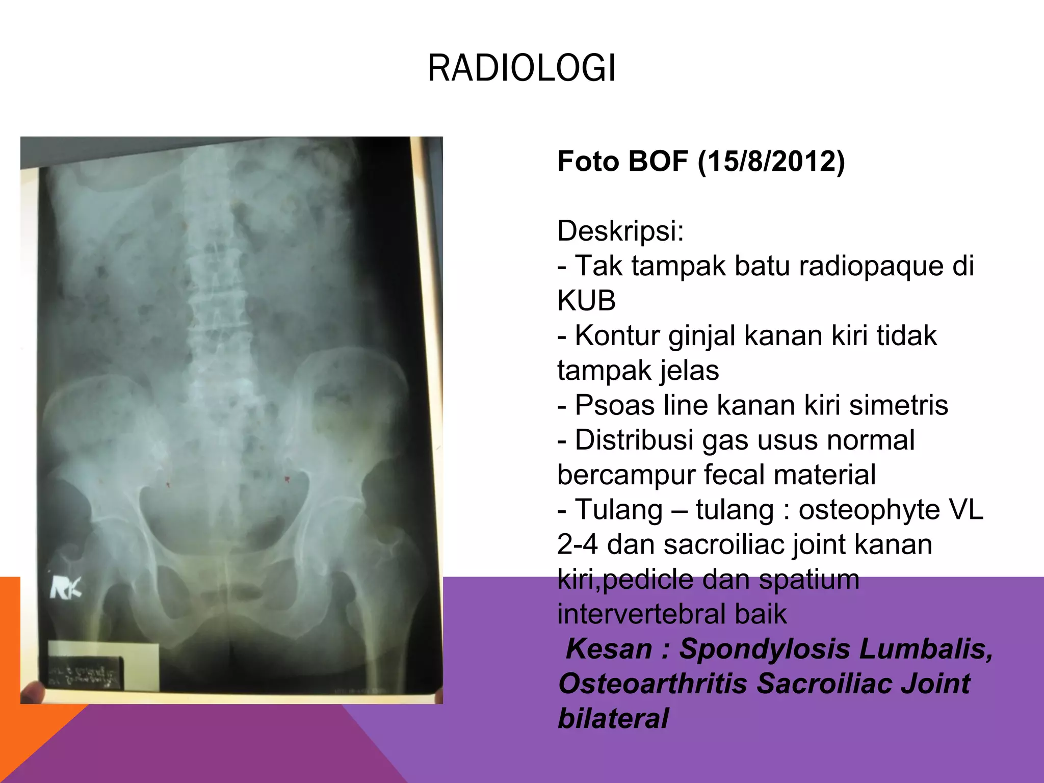 Powerpoint dmdf | PPT