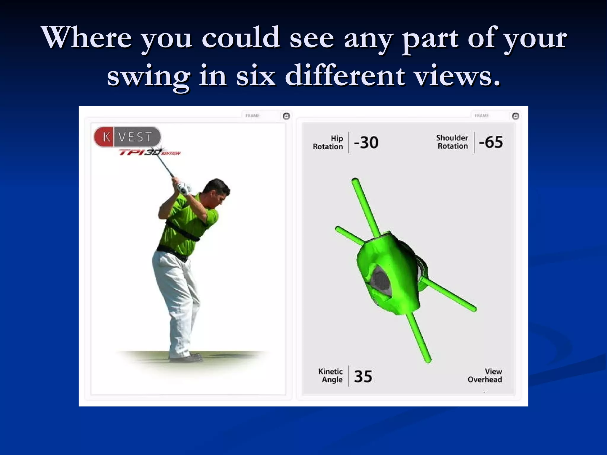 introduction to CGD | PPT