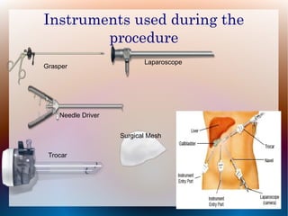 Powerpoint gallbladder | ODP