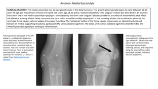 PowerPointHandout_AForearmPalmarHand.pdf