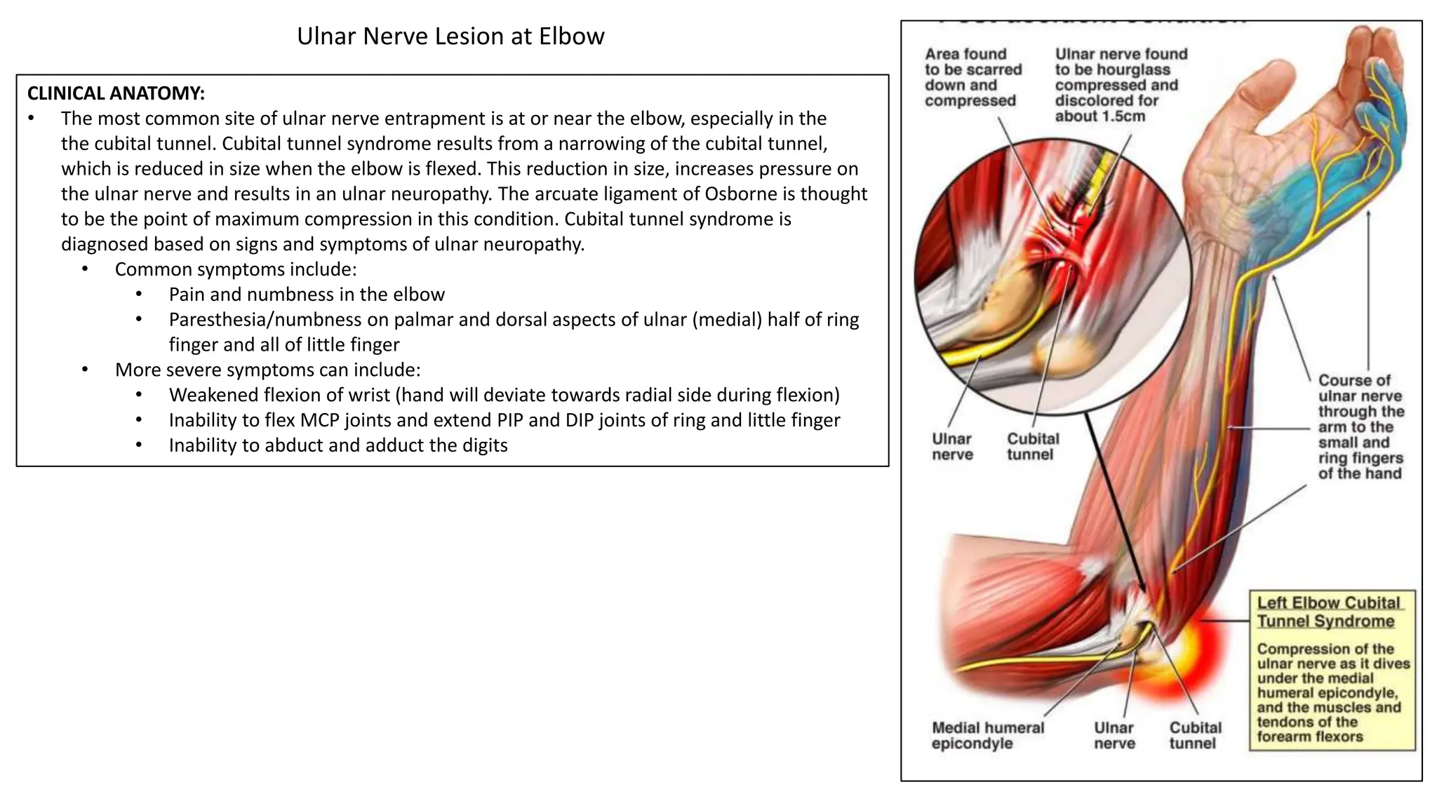 PowerPointHandout_ArmCubitalFossaElbow.pptx