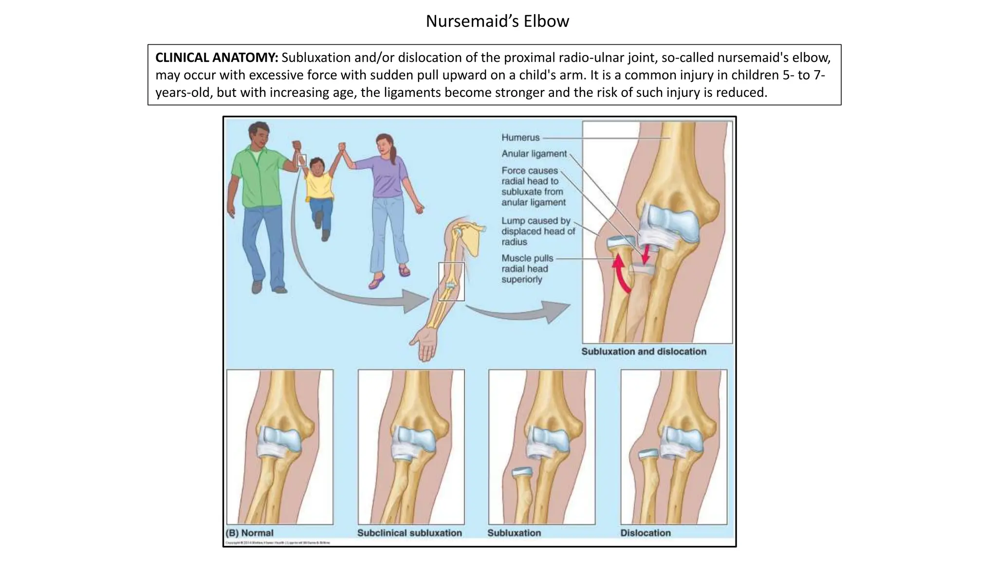 PowerPointHandout_ArmCubitalFossaElbow.pptx
