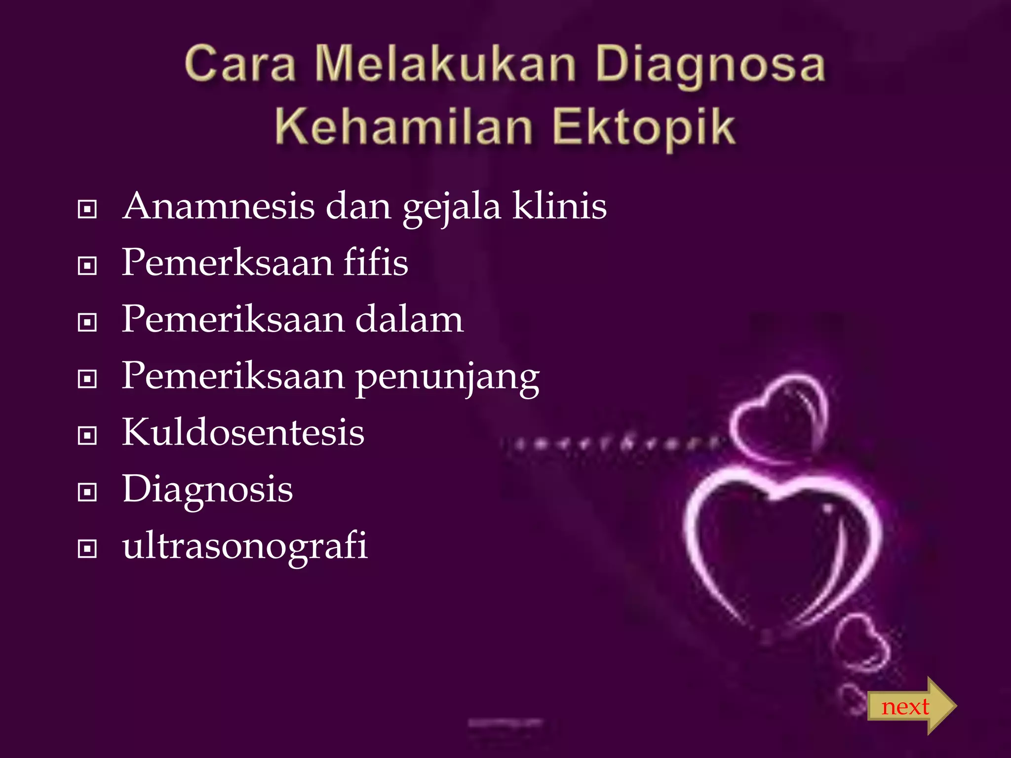 Power point kehamilan ektopika | PPT