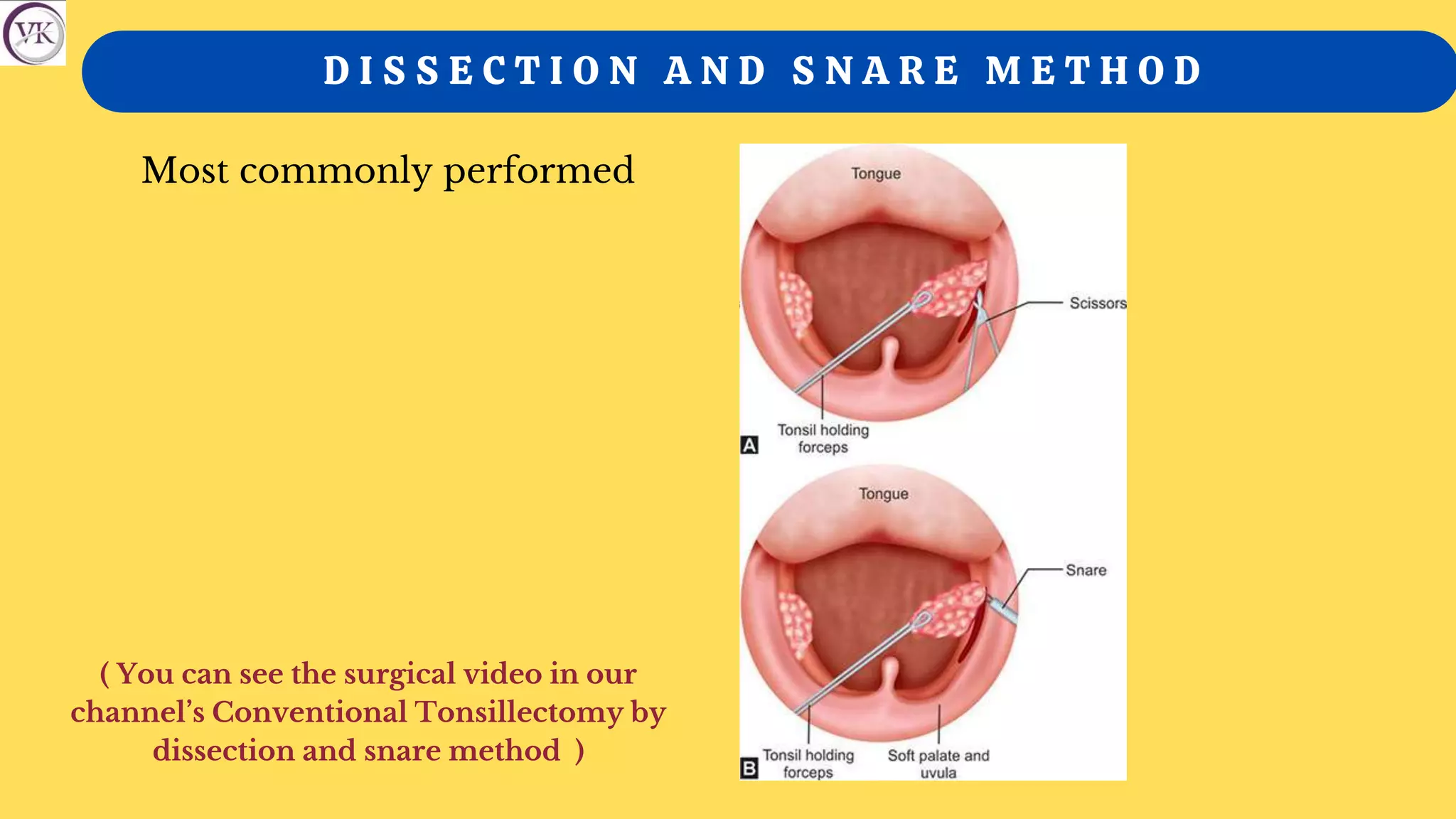 TONSILLECTOMY-INDICATIONS, CONTRAINDICATIONS,METHODS,SURGICAL STEPS AND ...