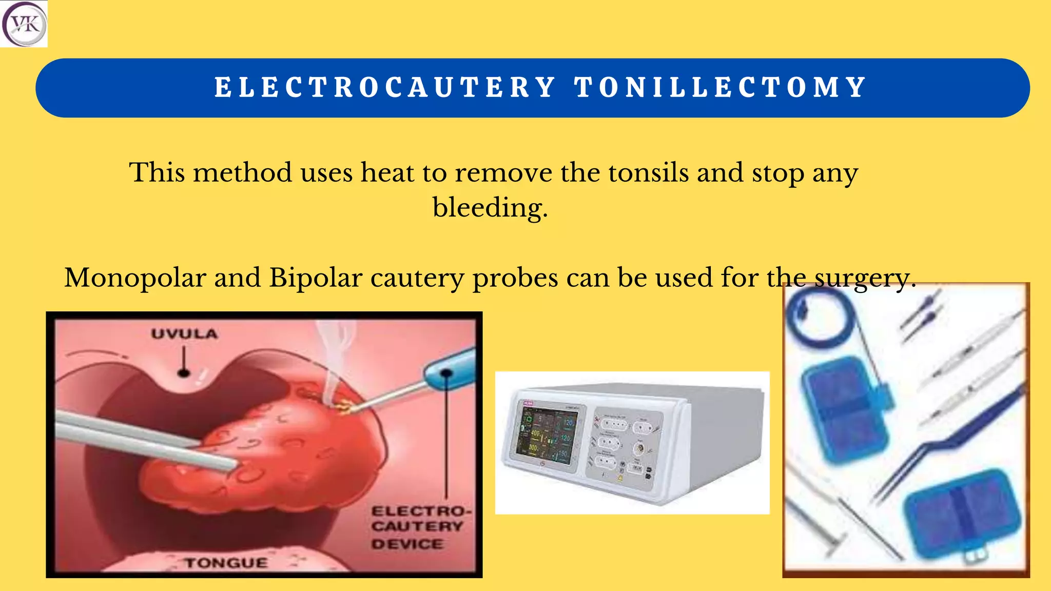 TONSILLECTOMY-INDICATIONS, CONTRAINDICATIONS,METHODS,SURGICAL STEPS AND ...