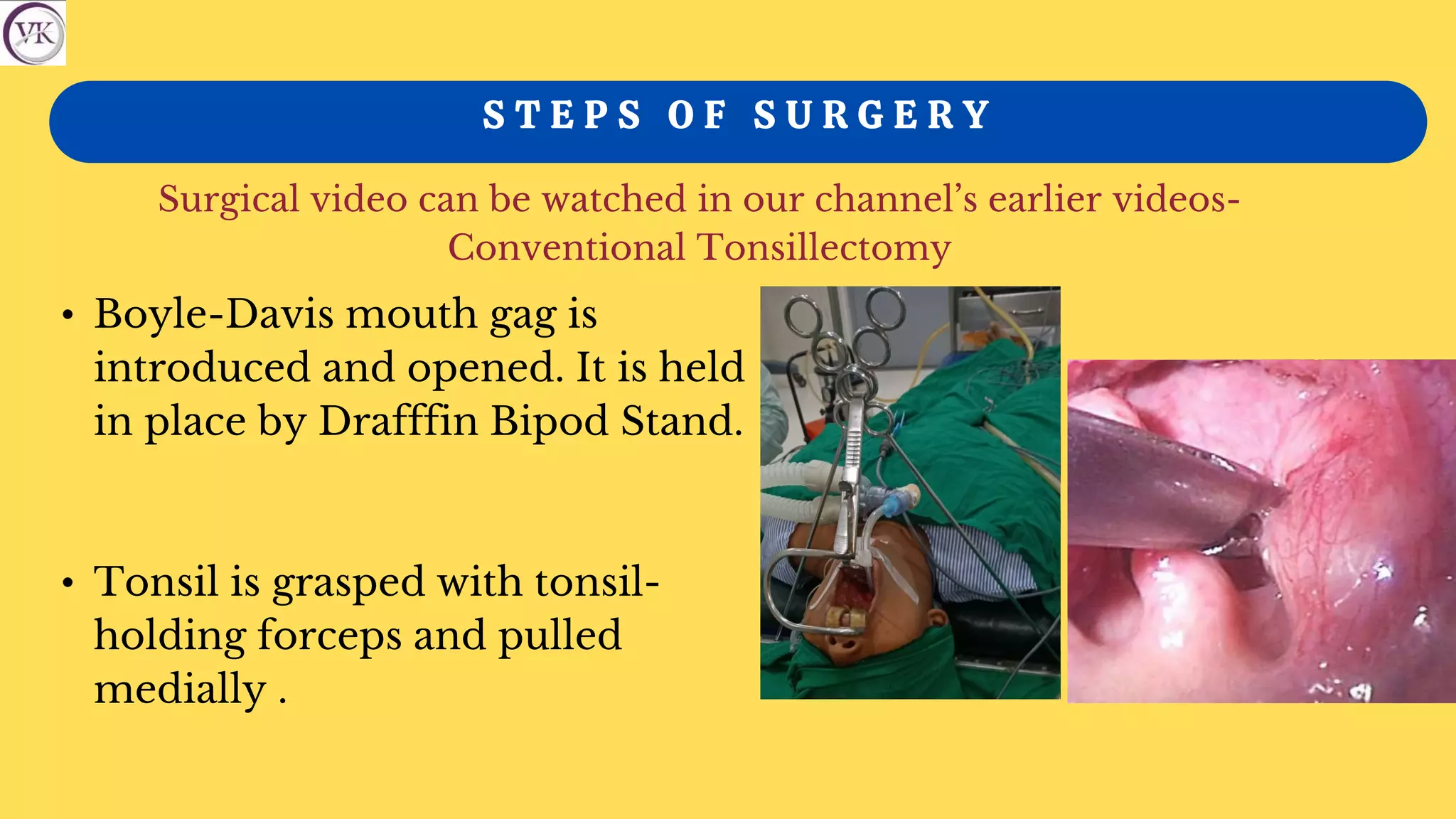 TONSILLECTOMY-INDICATIONS, CONTRAINDICATIONS,METHODS,SURGICAL STEPS AND ...