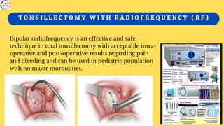 TONSILLECTOMY-INDICATIONS, CONTRAINDICATIONS,METHODS,SURGICAL STEPS AND ...