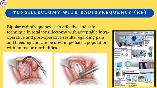 TONSILLECTOMY-INDICATIONS, CONTRAINDICATIONS,METHODS,SURGICAL STEPS AND ...