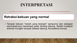 Pemeriksaan retraksi bekuan | PPTX