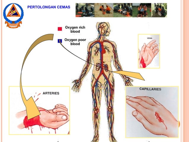 Power point pertolongan cemas | PPT