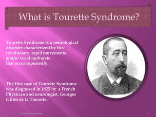 Power Point Presentation On Tourette | PPTX