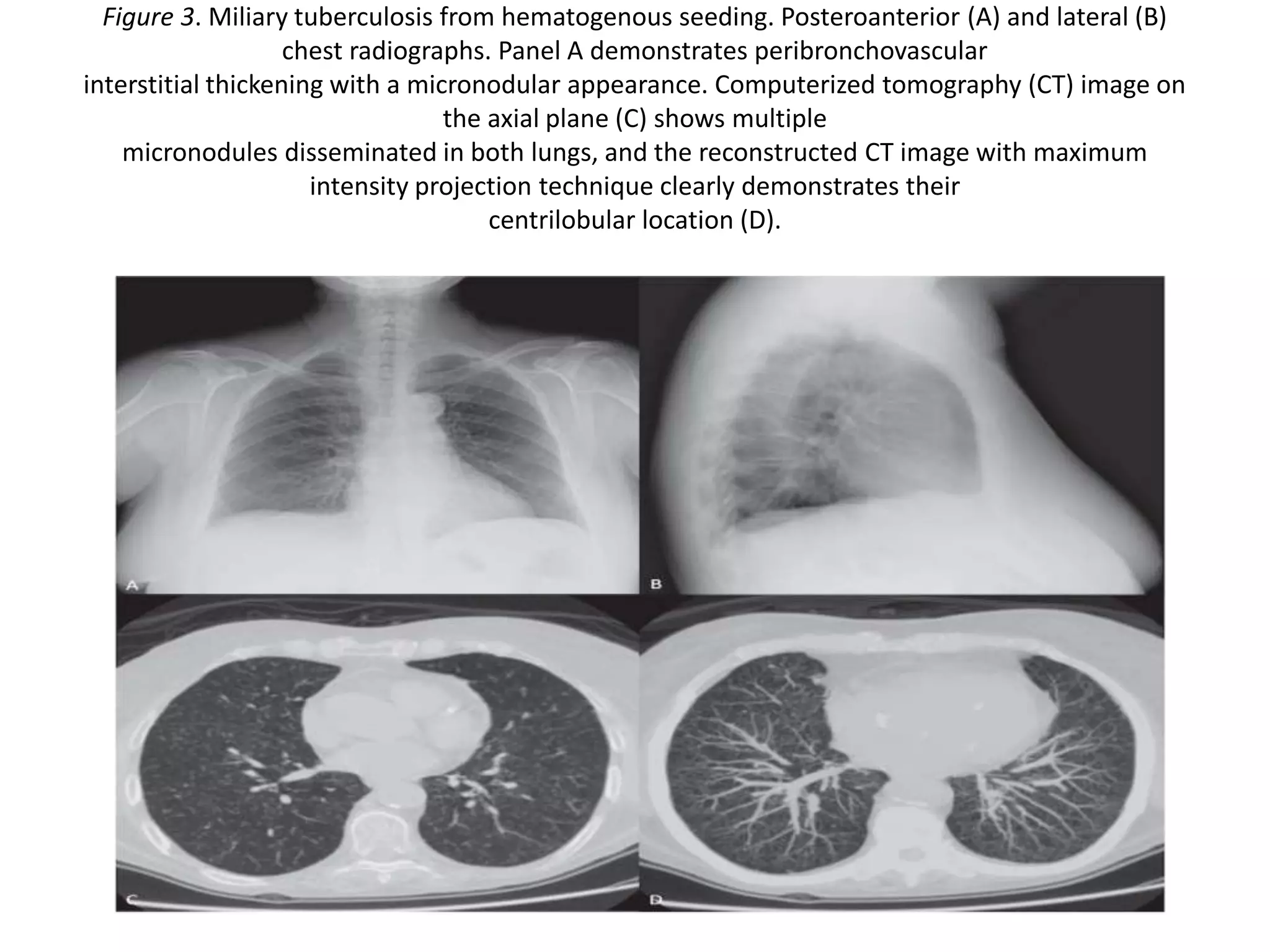 Power point radiologi | PPTX