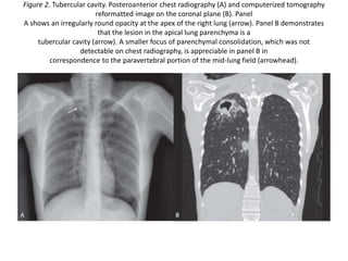 Power point radiologi | PPTX