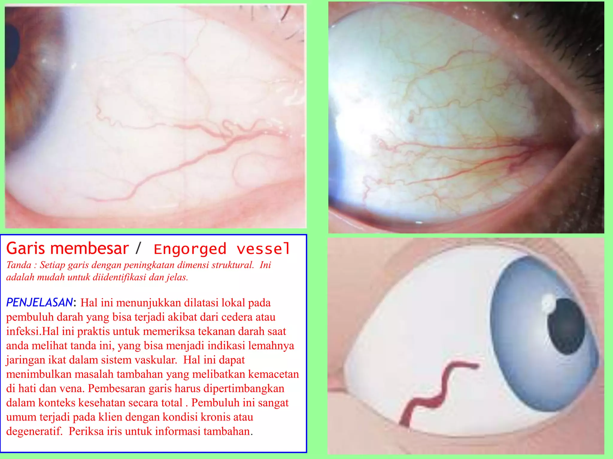 Power point sclerology miller. | PPT