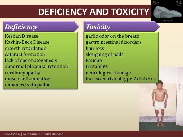 Selenium in Health and Nutrition