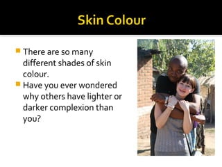 Powerpoint skin colour_and_vitiligo | PPT