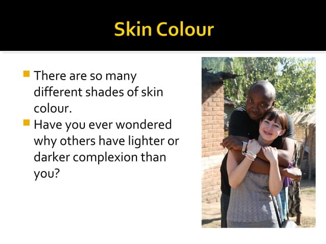 Powerpoint skin colour_and_vitiligo | PPT | Skin and Dermatology ...