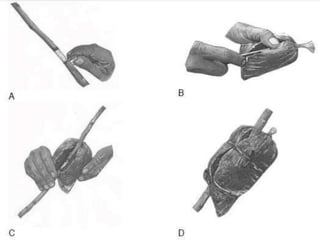 Power_point_teks_prosedur.pptx procedure text | PPTX