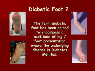 bio mechanics of diabetic foot ulcer | PPTX