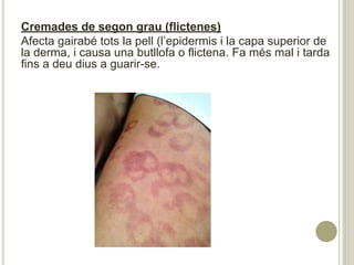 Lesions per fred, calo i electricitat.pptx.pptx