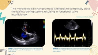 power tfg con correcciones.pptx
