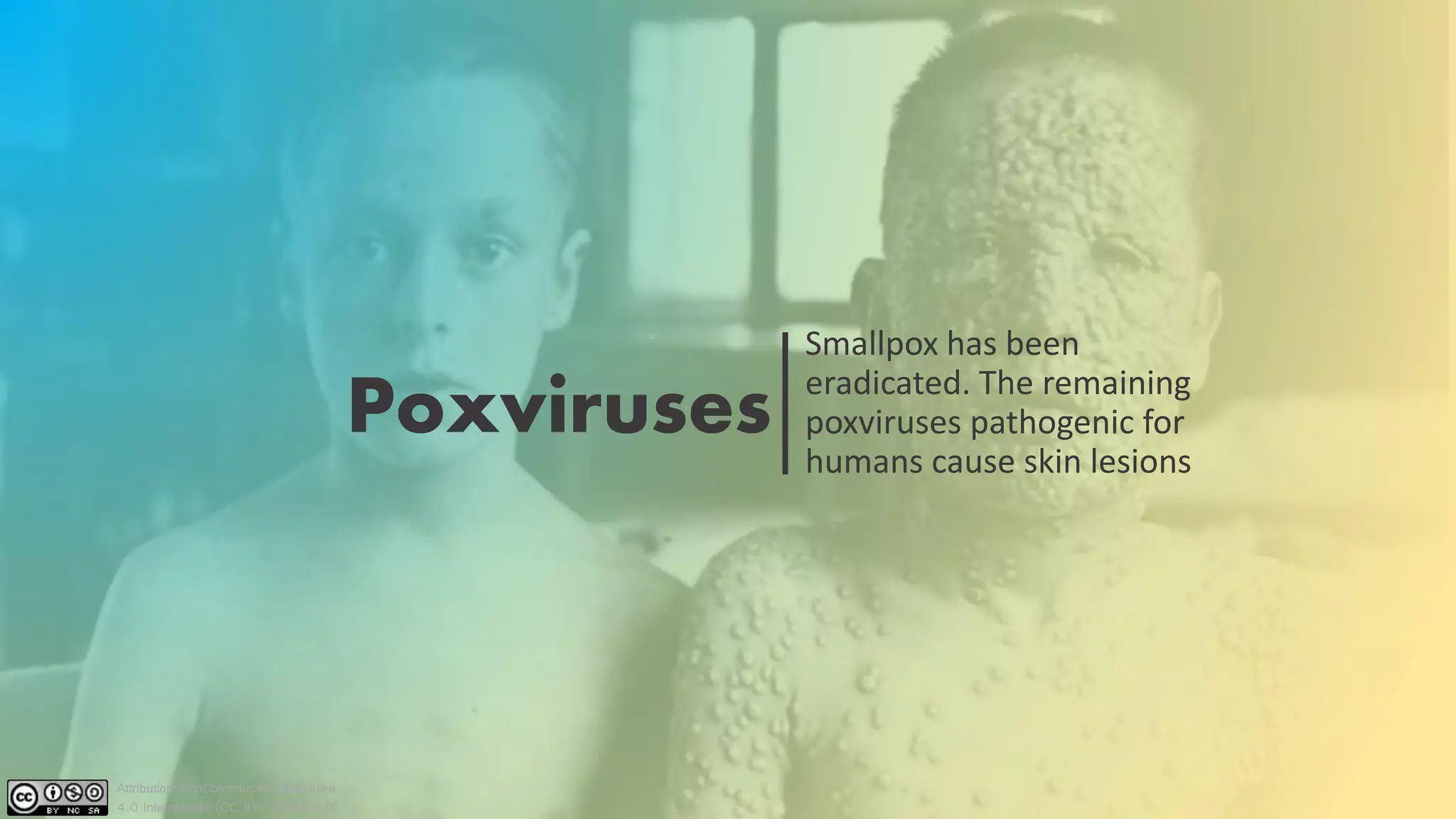 Poxvirus | PDF