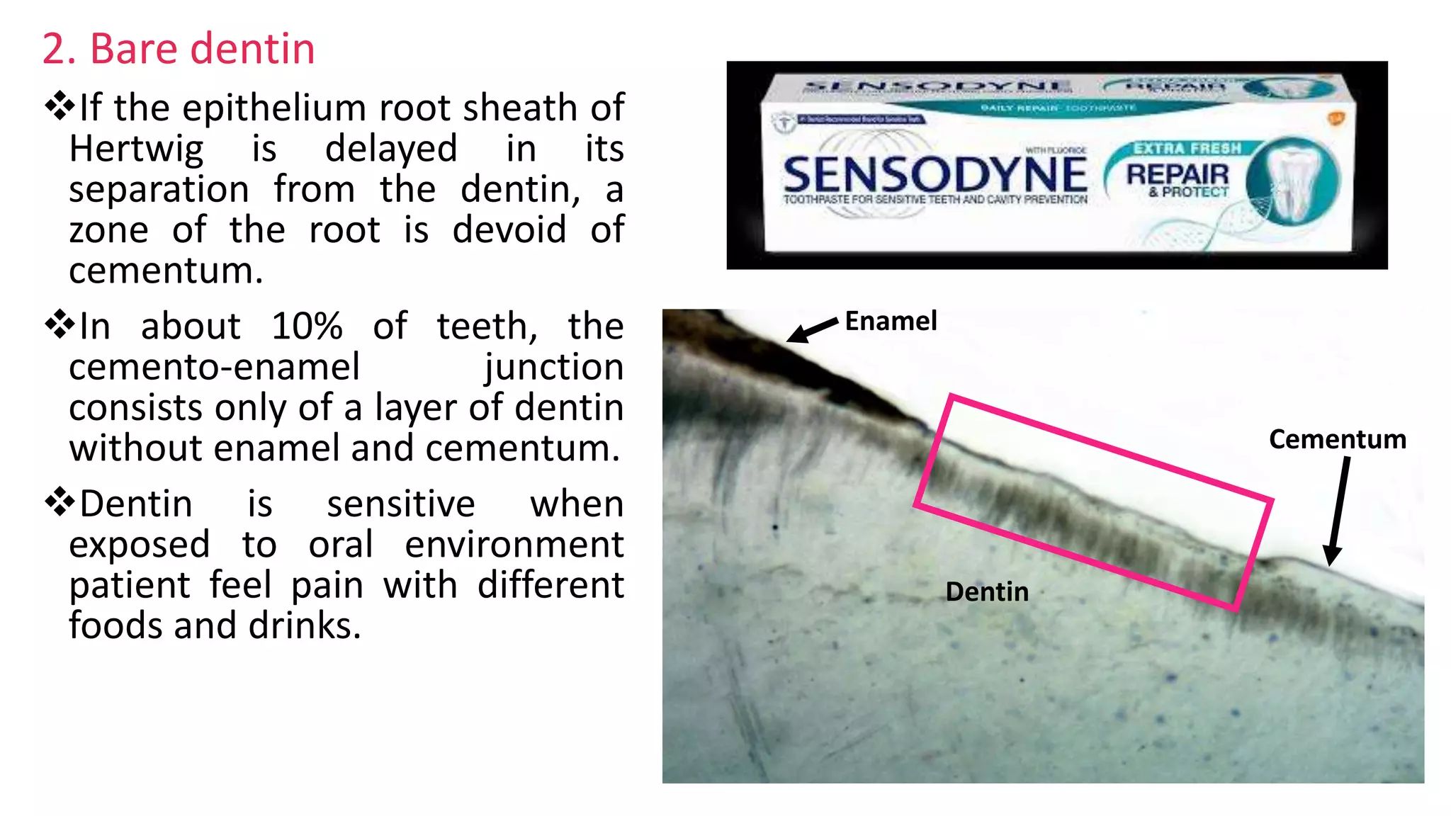 Tooth development 2 | PPTX
