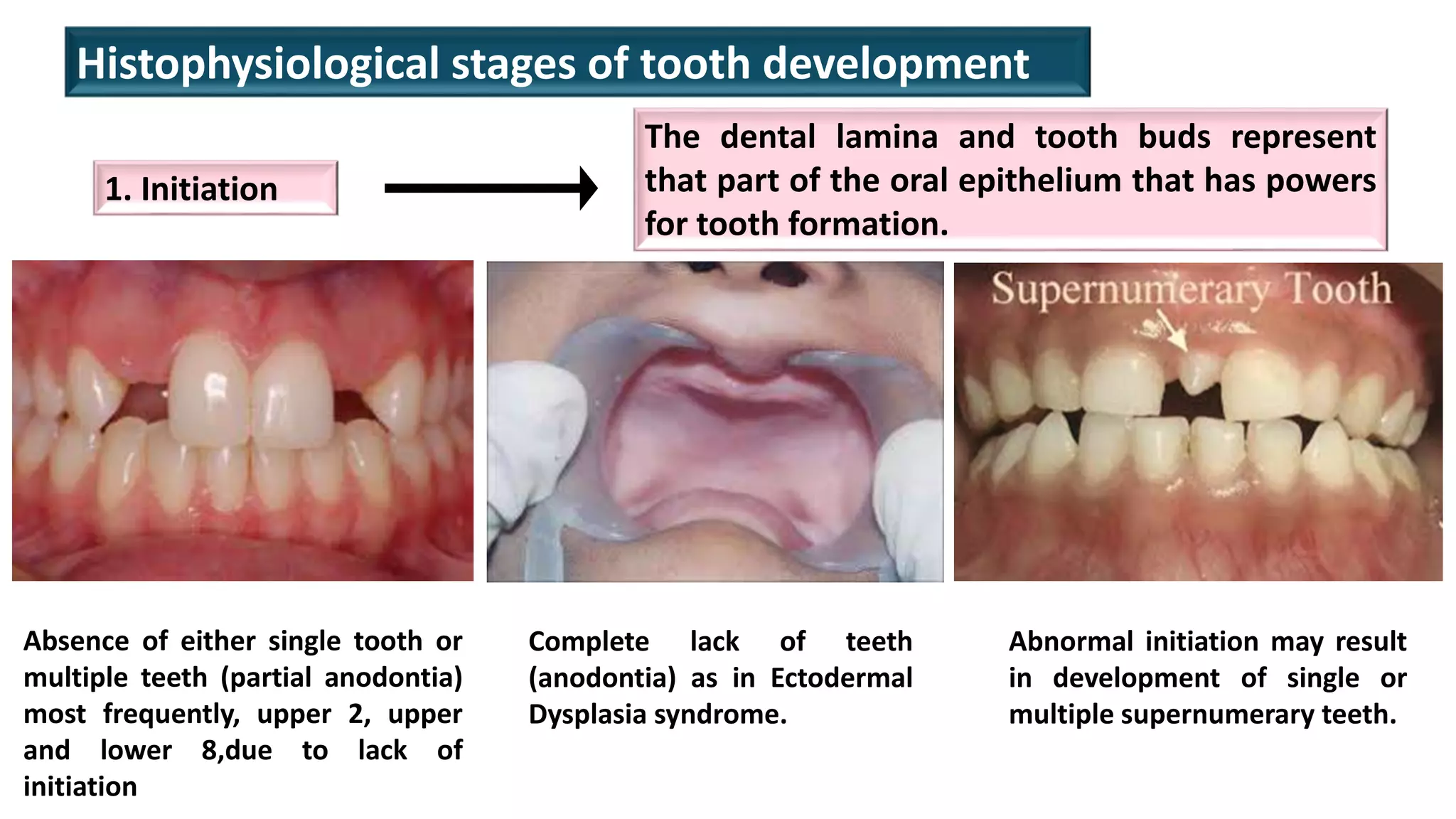 Tooth development 2 | PPTX