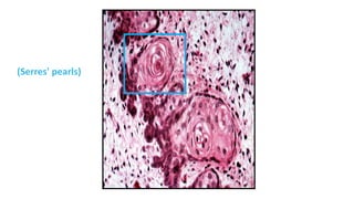 Tooth development 2 | PPTX