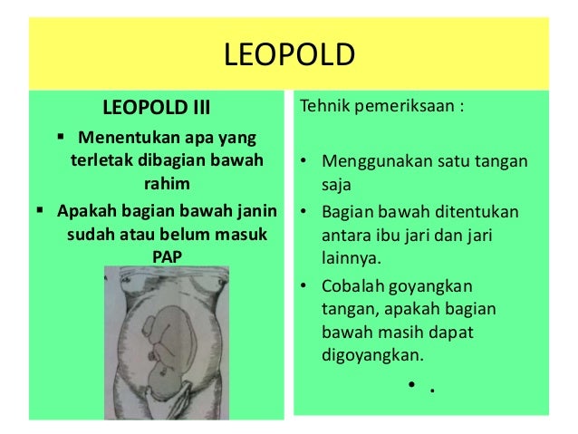Pp.leopold