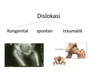 Dislokasi Sendi | PPTX