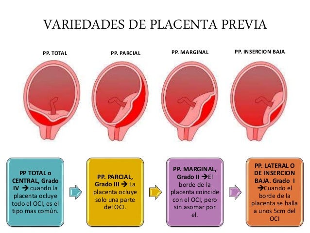 Que Es Placenta Su Definicion Y Significado 2021 Kitchen